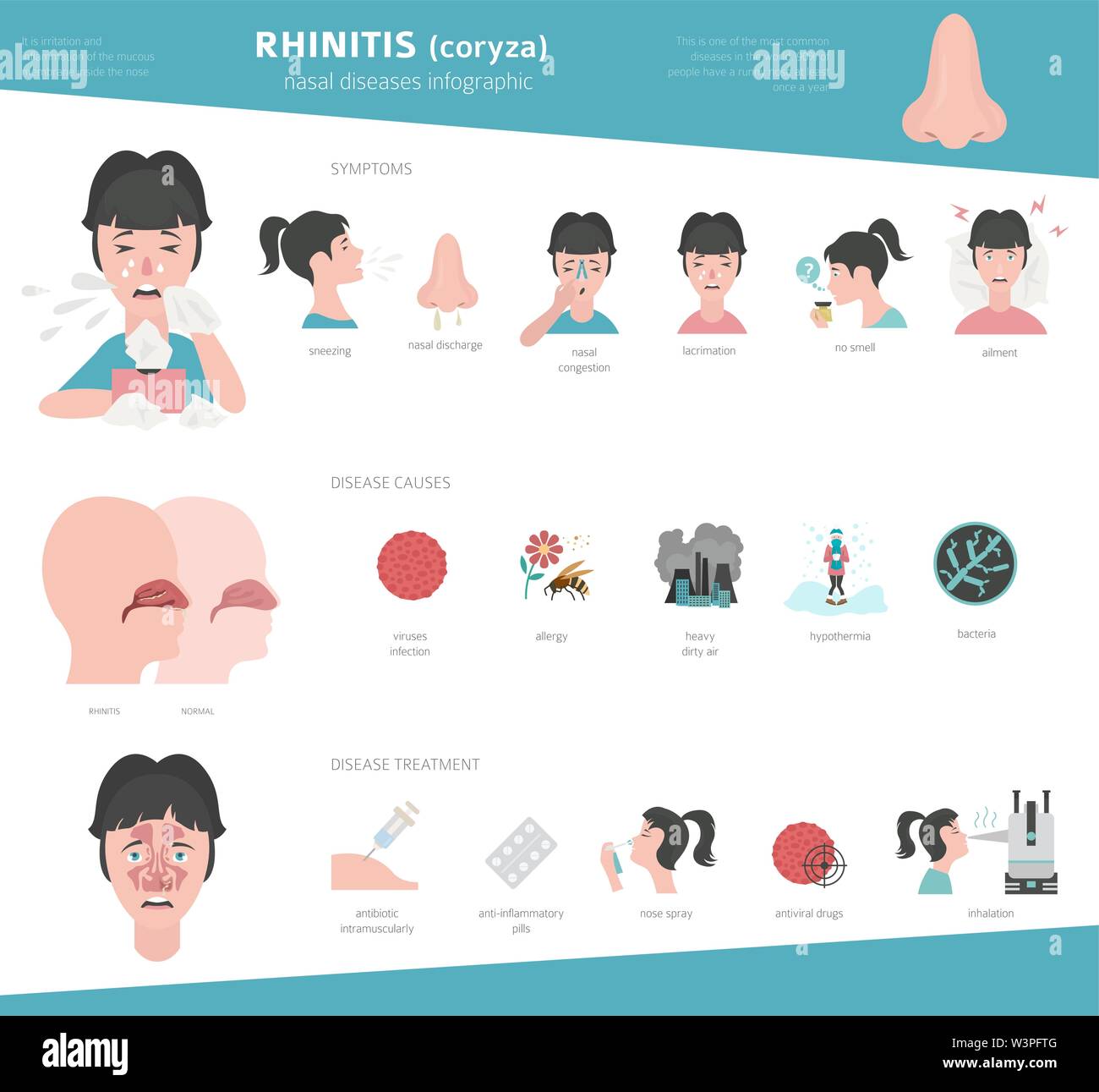 Nasal diseases. Rhinitis symptoms, treatment icon set. Medical ...