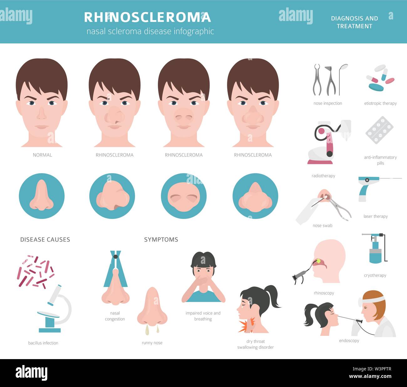 Nasal diseases. Rhinoscleroma symptoms, nasal scleroma treatment icon ...