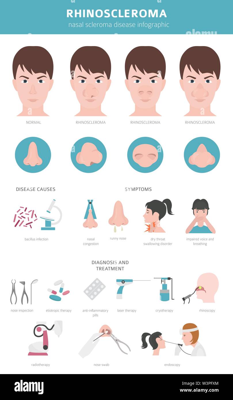 Nasal diseases. Rhinoscleroma symptoms, nasal scleroma treatment icon ...