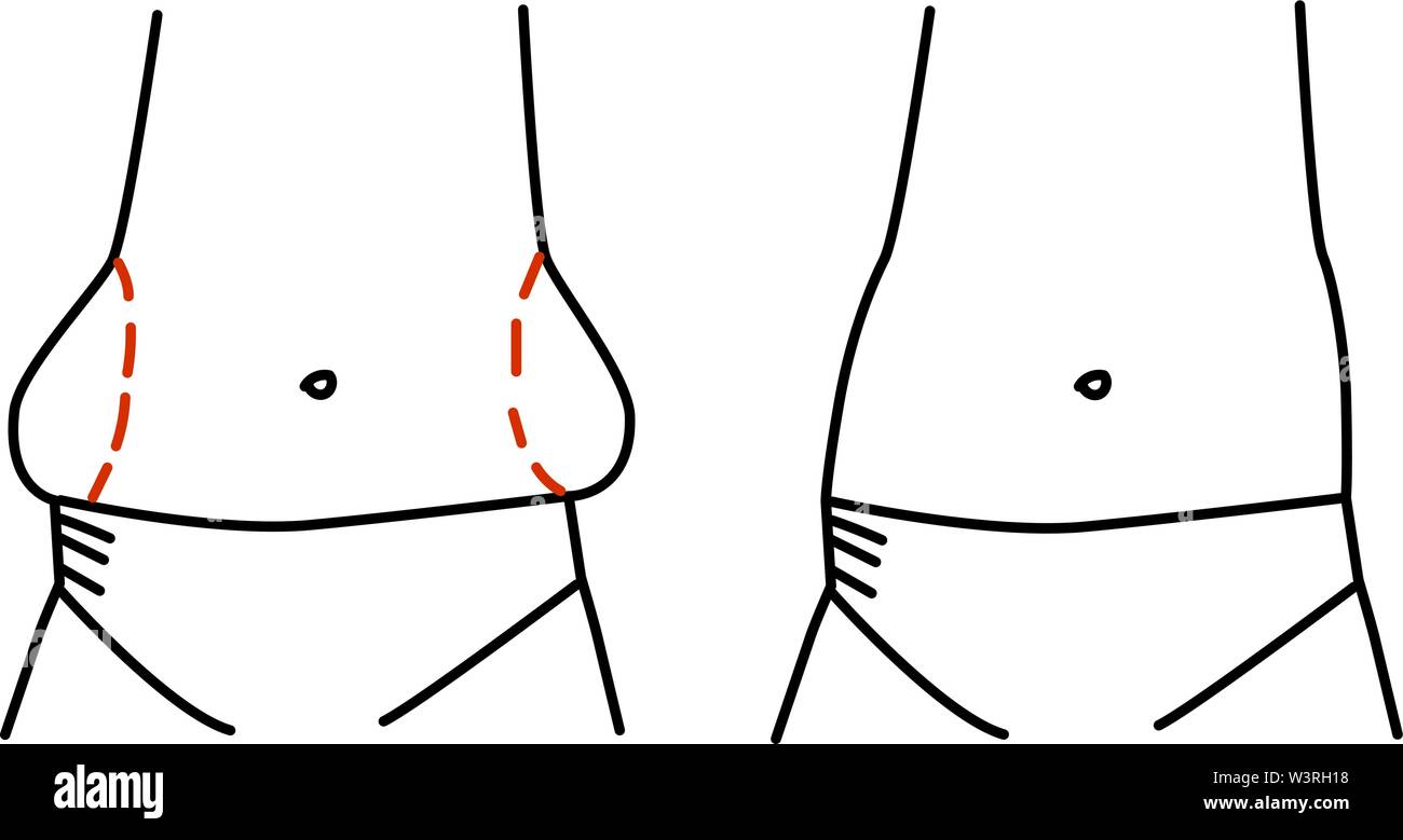 Obese man fat stomach side Cut Out Stock Images & Pictures - Alamy