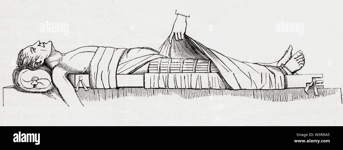 Listons long splint hi-res stock photography and images - Alamy