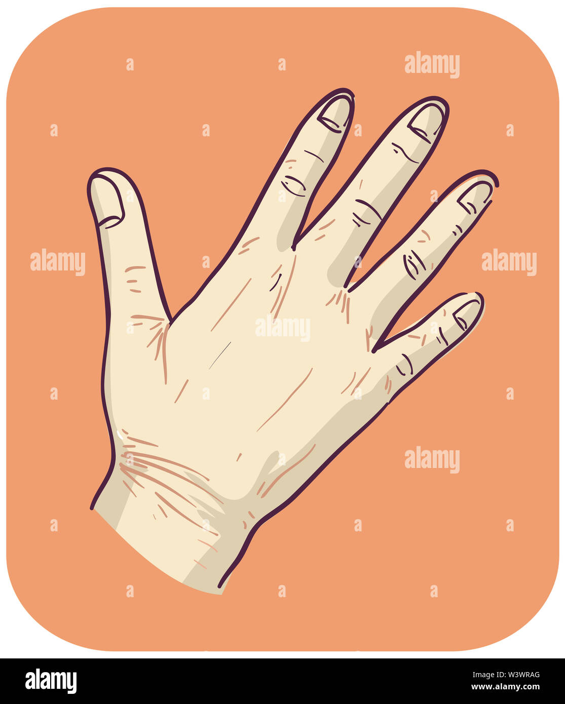 Illustration of a Hand with Thin or Fragile Skin Stock Photo - Alamy