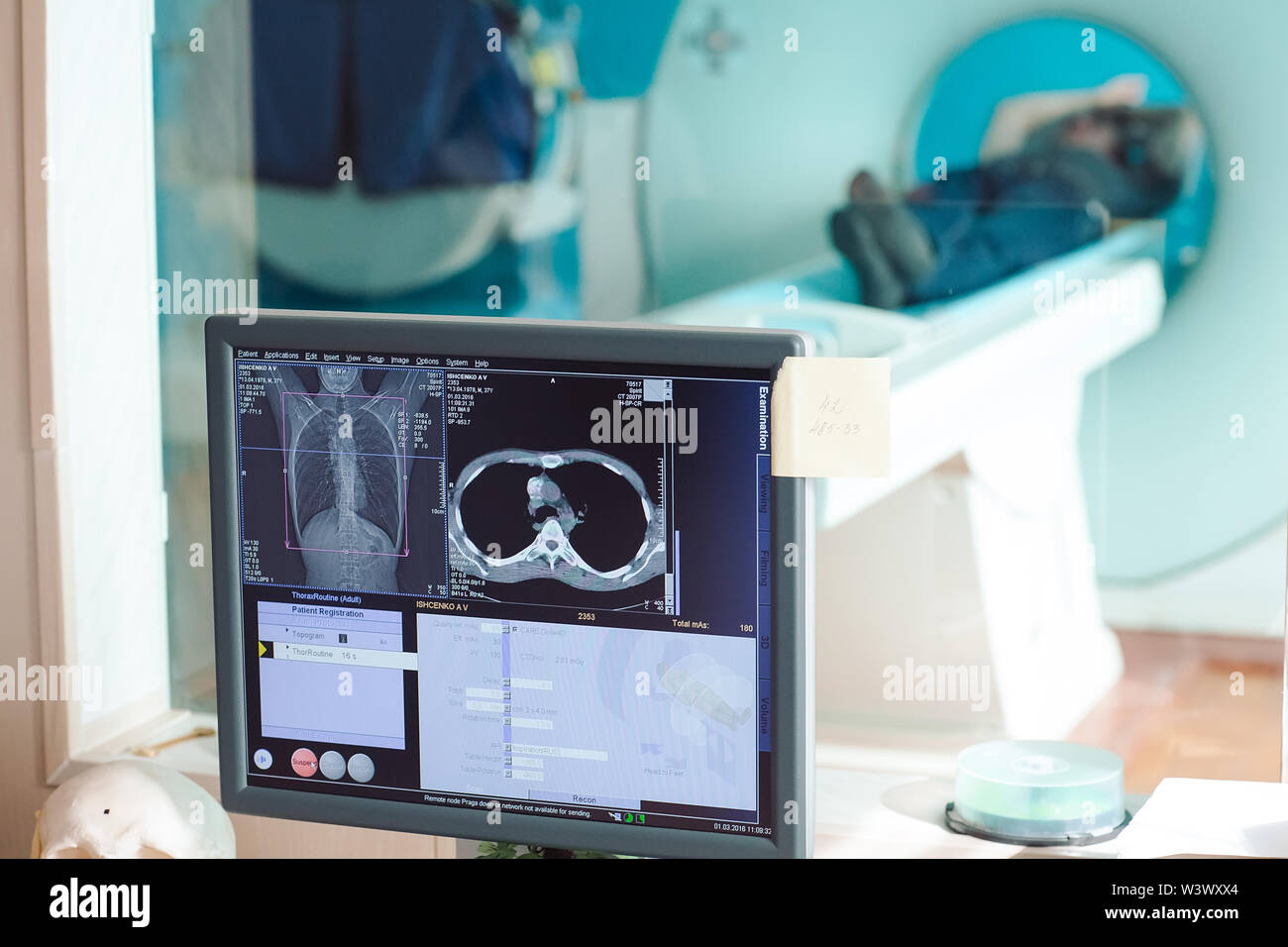 MRI machine and screens with doctor and nurse Stock Photo - Alamy