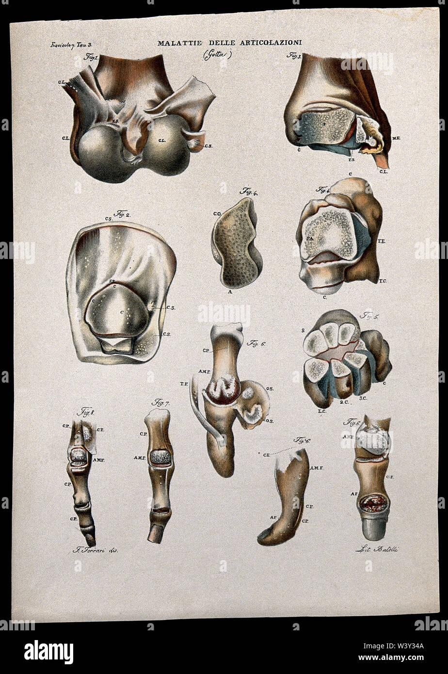 Gout Cartoon High Resolution Stock Photography and Images - Alamy