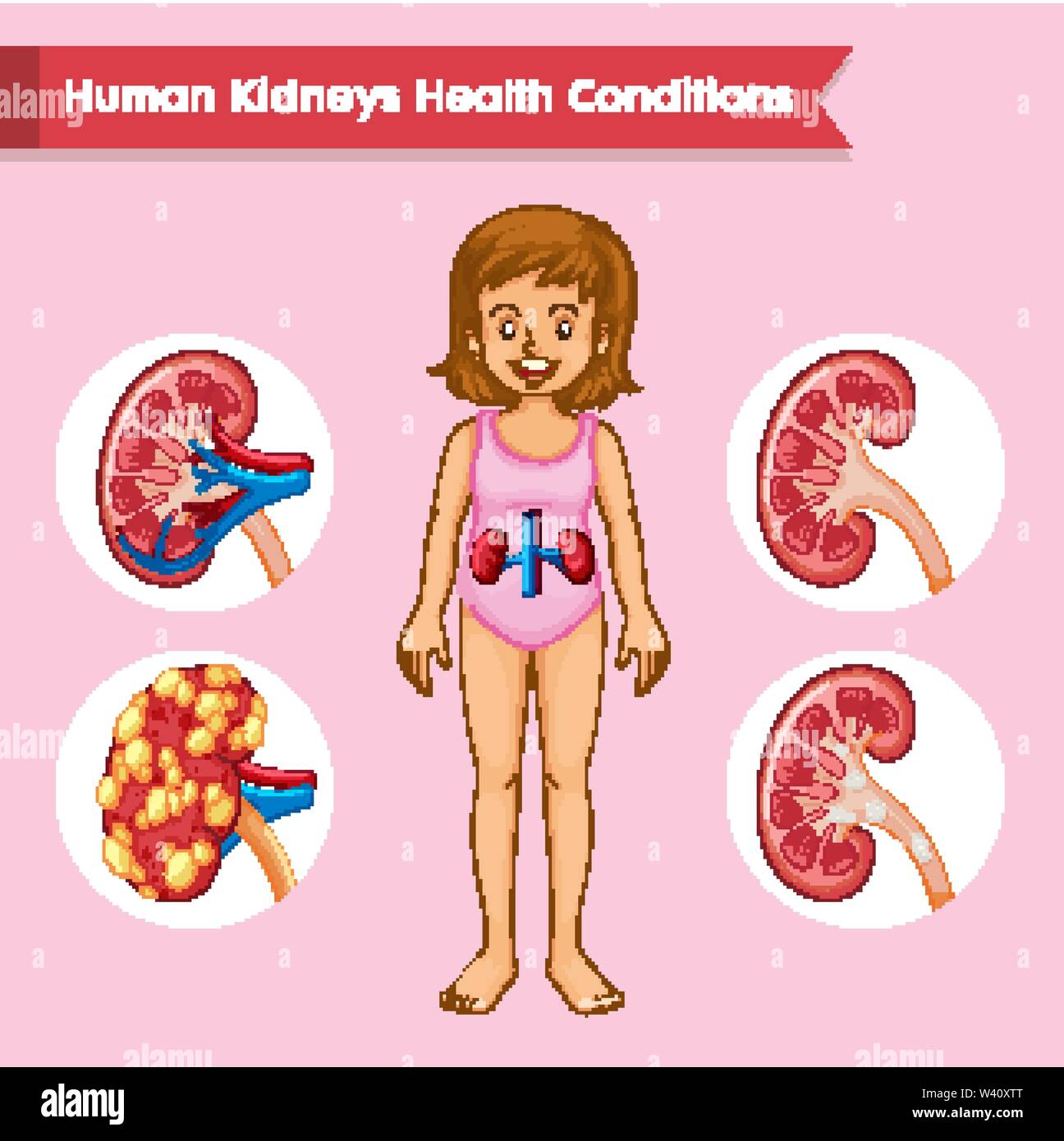 Scientific medical illustration of kidney health illustration Stock ...