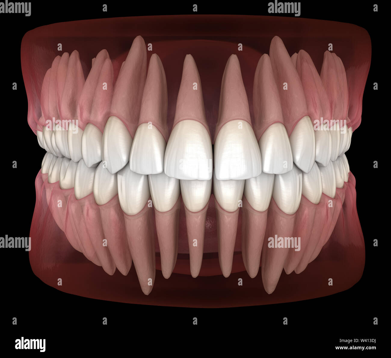 Morphology of mandibular and maxillary human gum and teeth. Medically ...