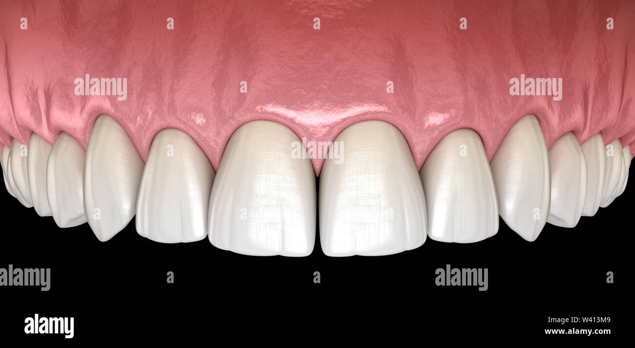 Maxillary human gum and teeth. Medically accurate tooth 3D illustration ...