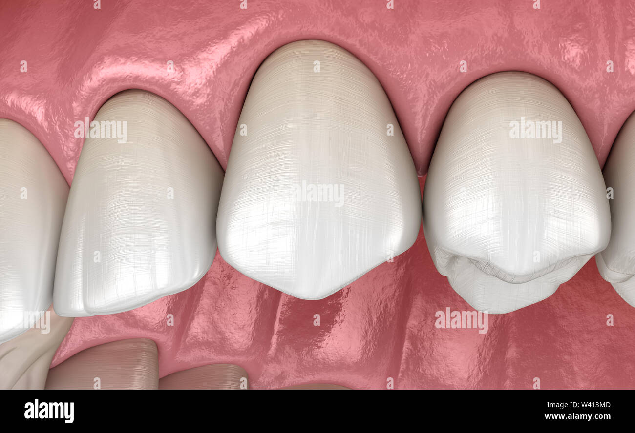Maxillary human gum and teeth. Medically accurate tooth 3D illustration ...
