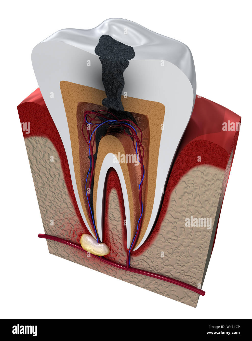 Tooth decay bacteria Cut Out Stock Images & Pictures - Alamy