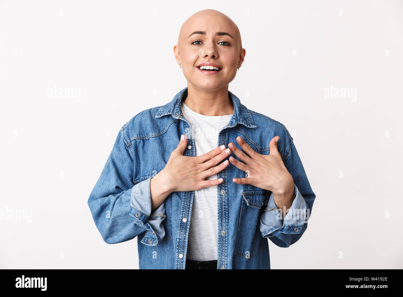 Portrait of a beautiful excited young hairless woman wearing casual ...