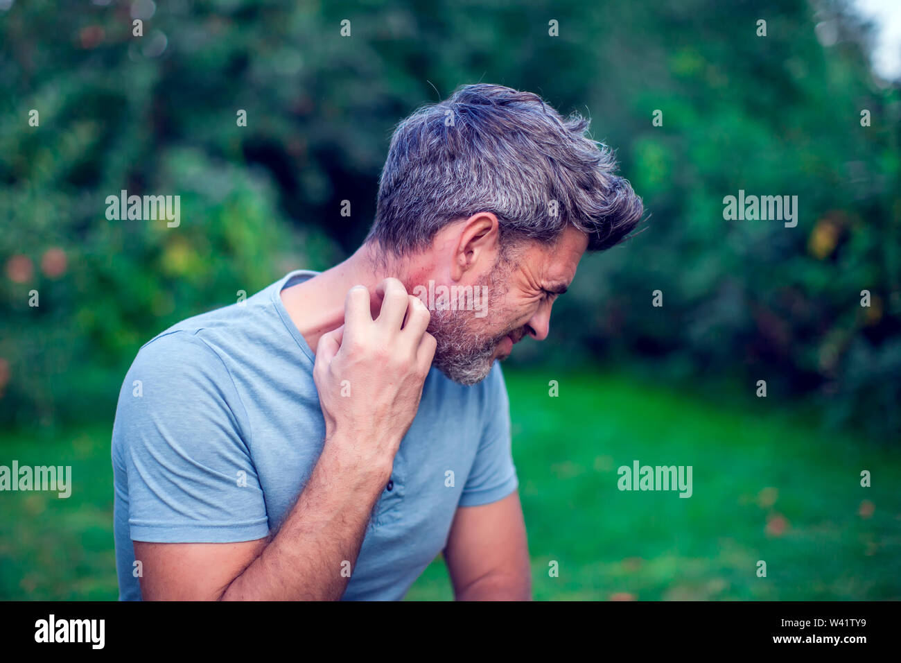 People scratch the itch with hand outdoor, Elbow, itching, Healthcare ...