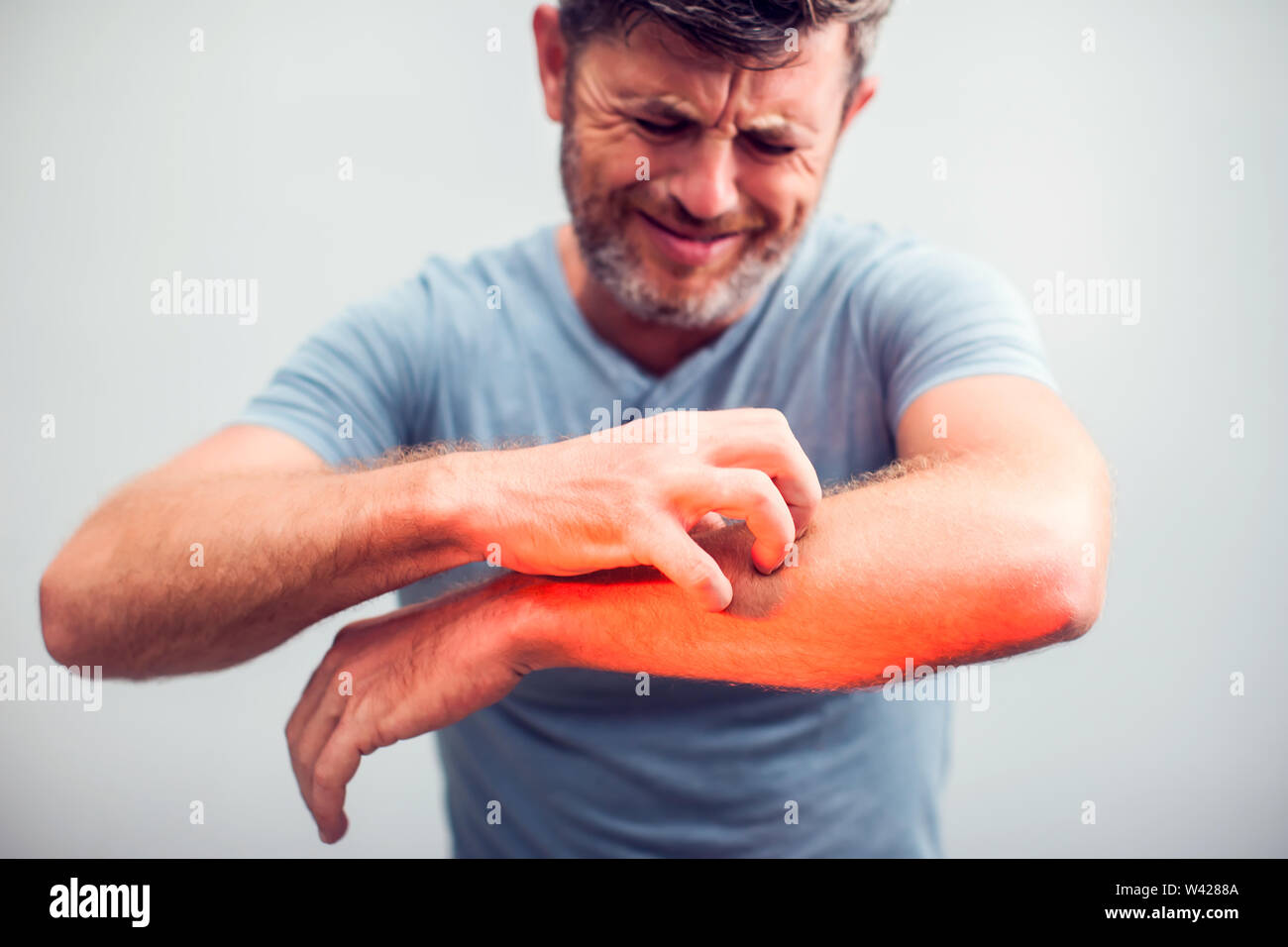 People scratch the itch with hand, Elbow, itching, Healthcare And ...