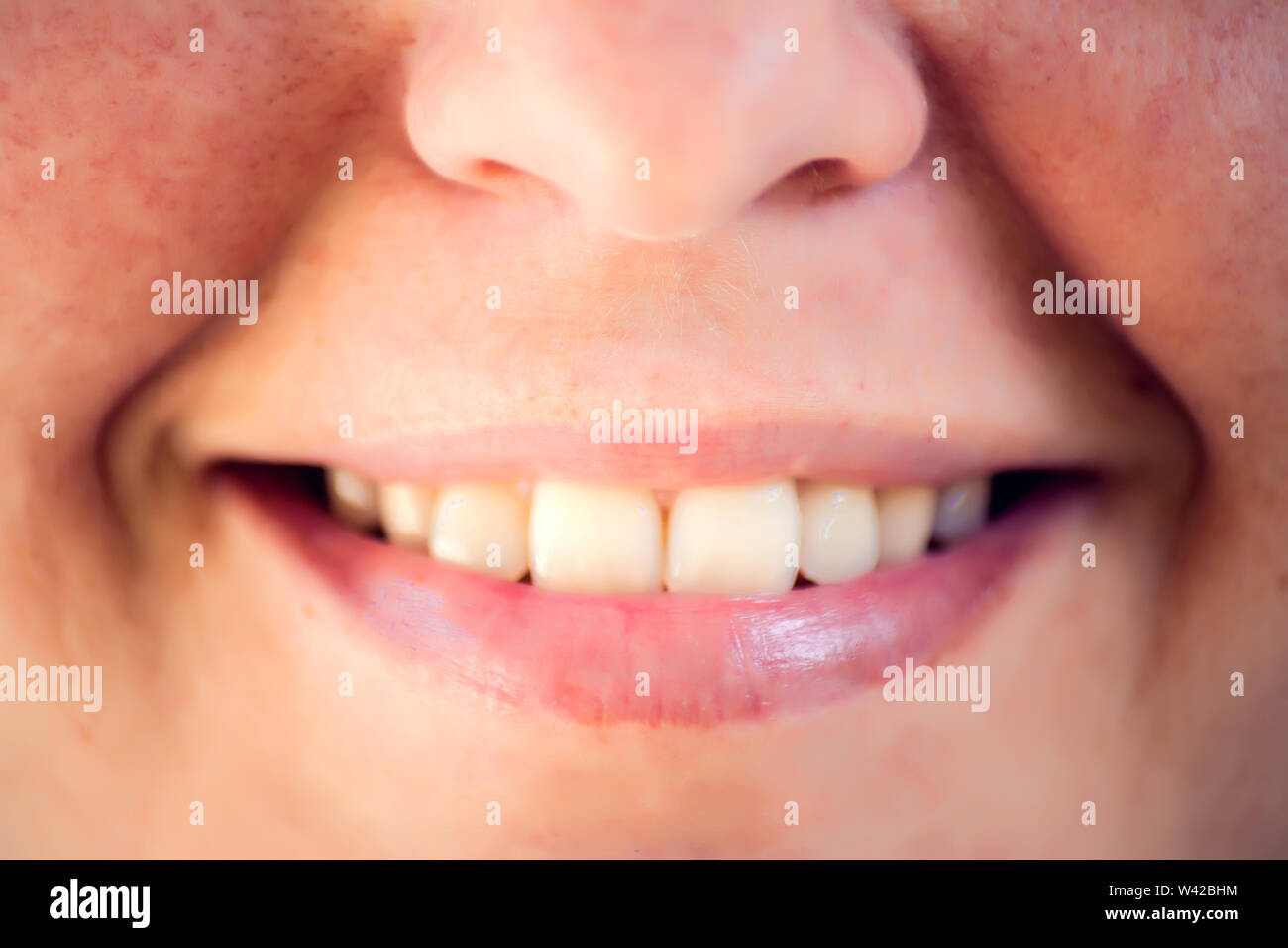 Human mouth open wide teeth hi-res stock photography and images - Alamy