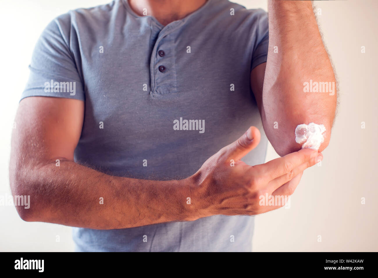 Man applies cream on dry elbow.People, healthcare and medicine concept ...