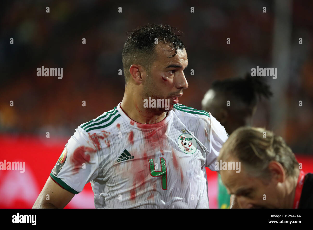 Cairo, Egypt. 19th July, 2019. Algeria's Djamel Benlamri bleeds after a ...