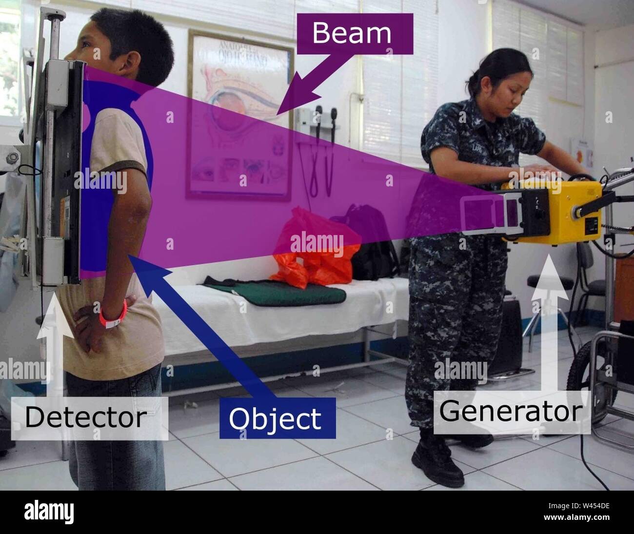 Components of projectional radiography Stock Photo - Alamy