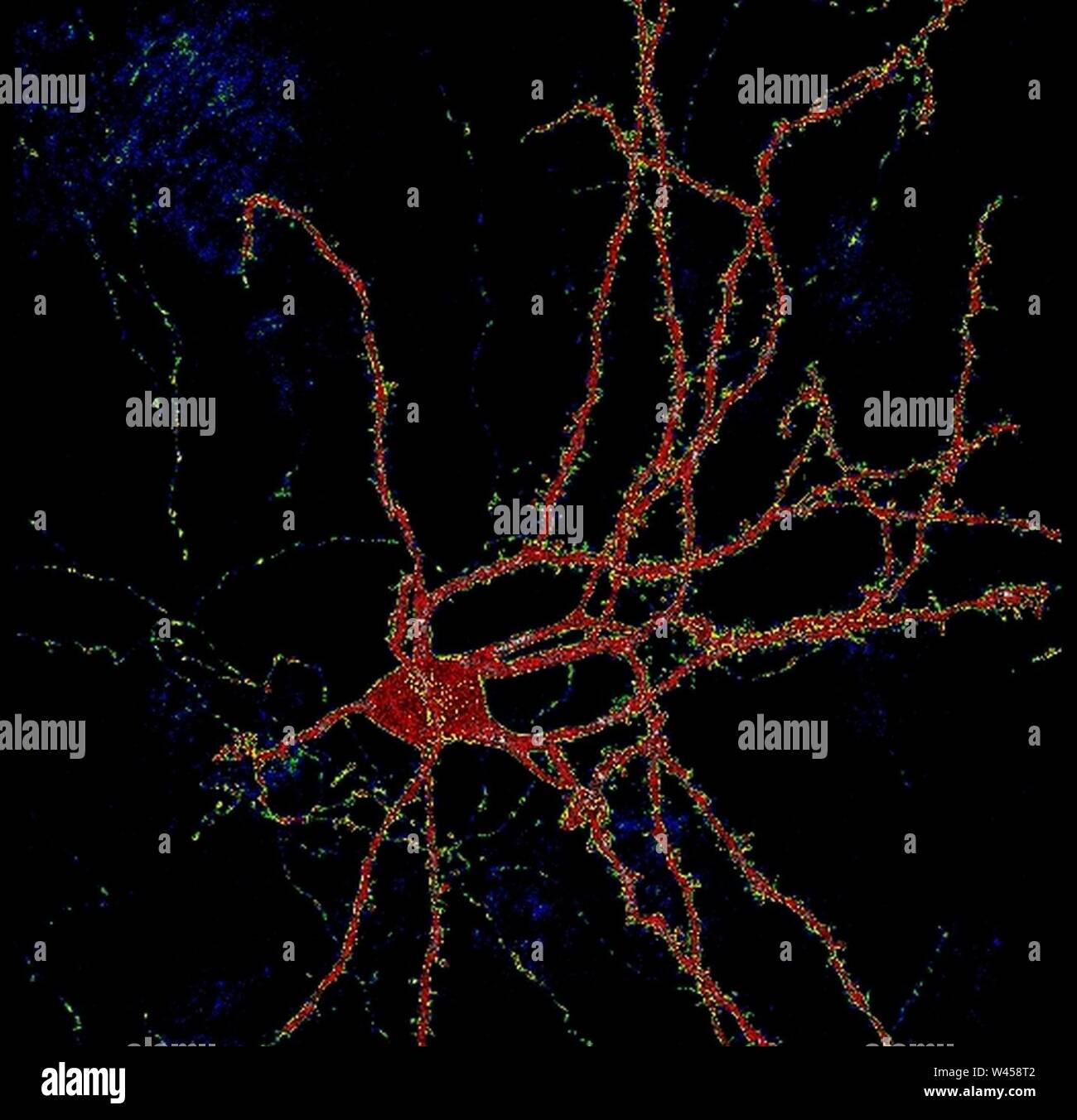 Confocal image of spiny neuron Stock Photo - Alamy