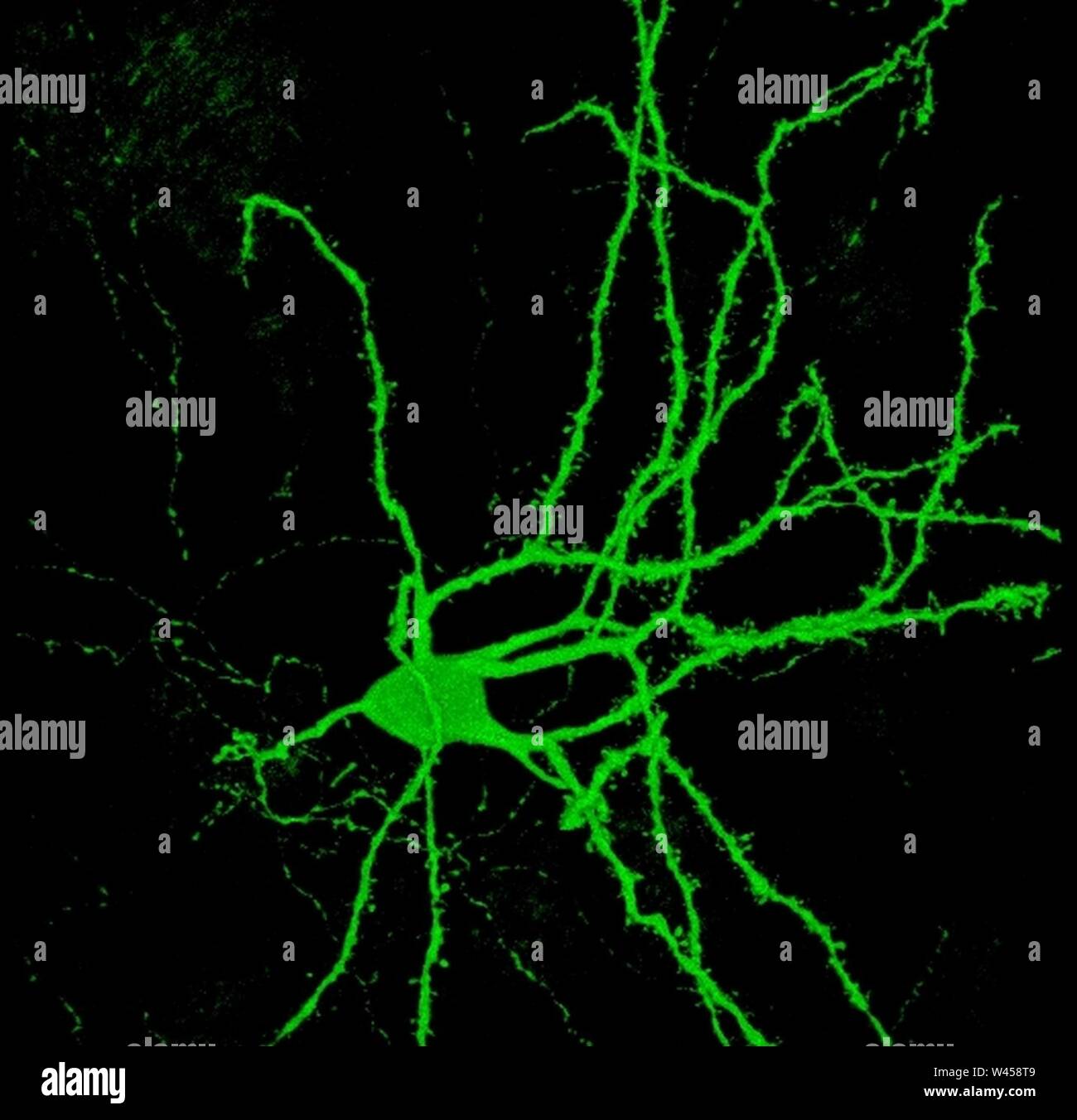 Confocal image of spiny neuron - 1 Stock Photo - Alamy