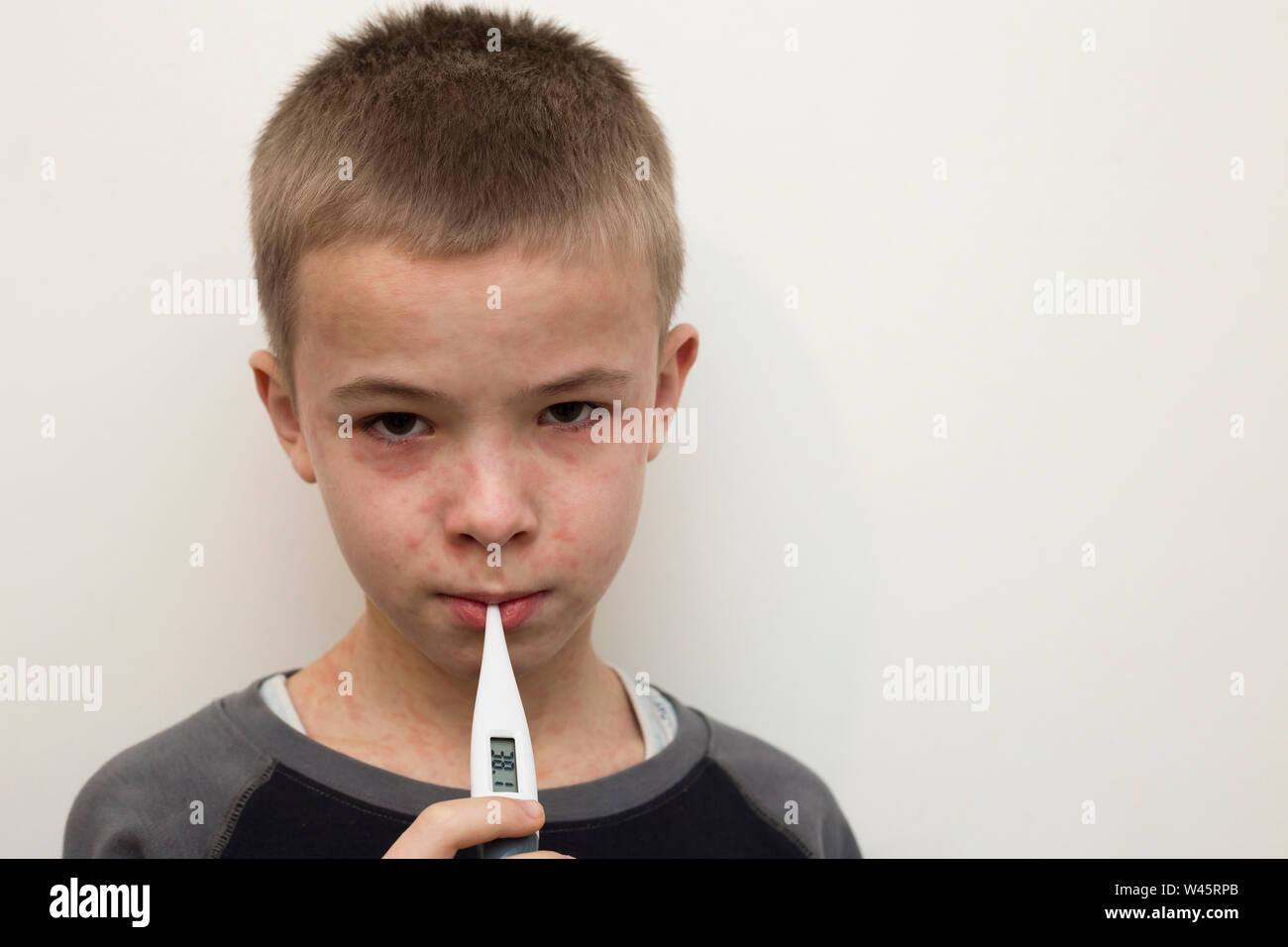 Portrait of sick sad boy child with thermometer having fever suffering ...