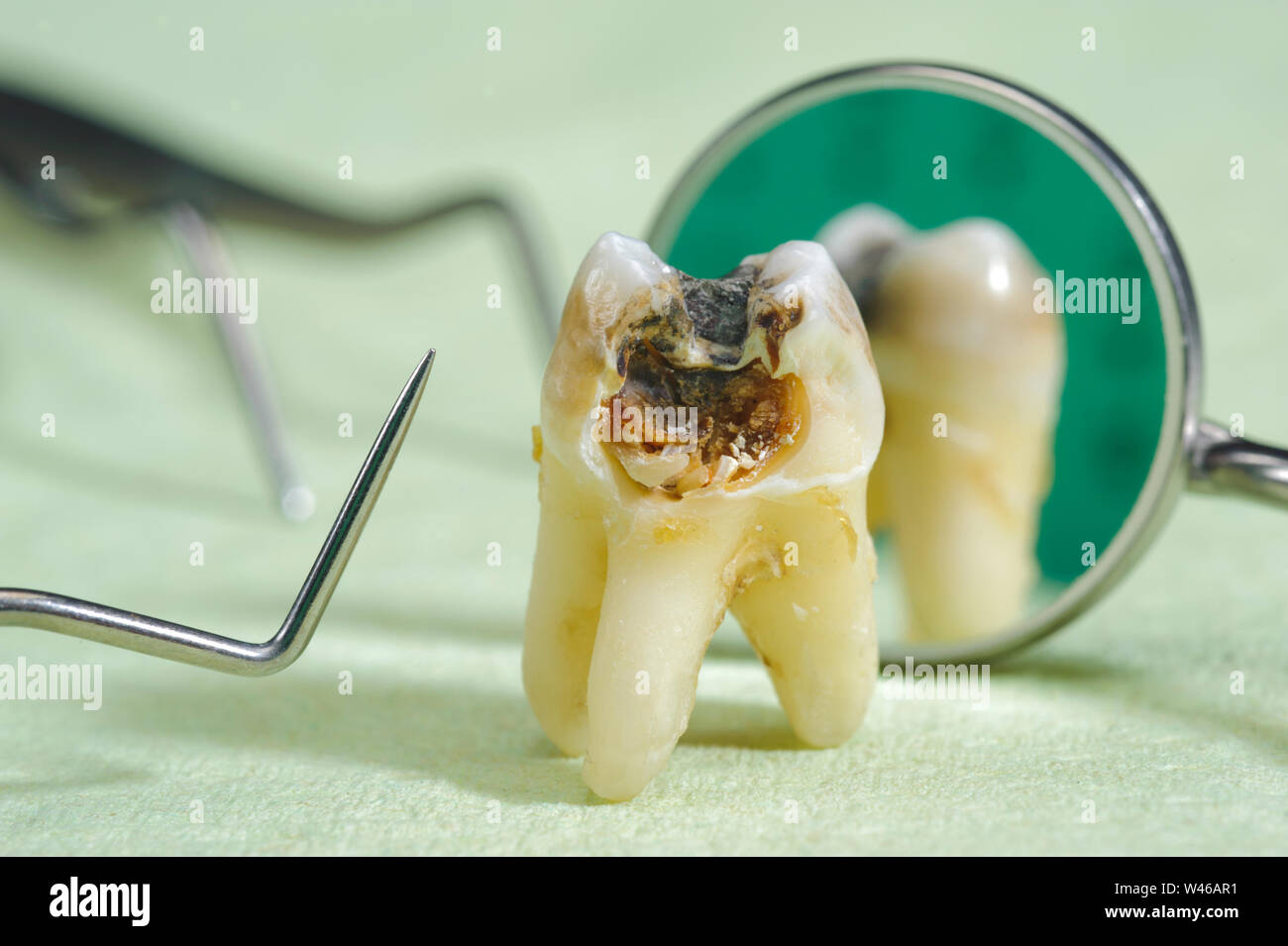 Molar anatomy hi-res stock photography and images - Alamy