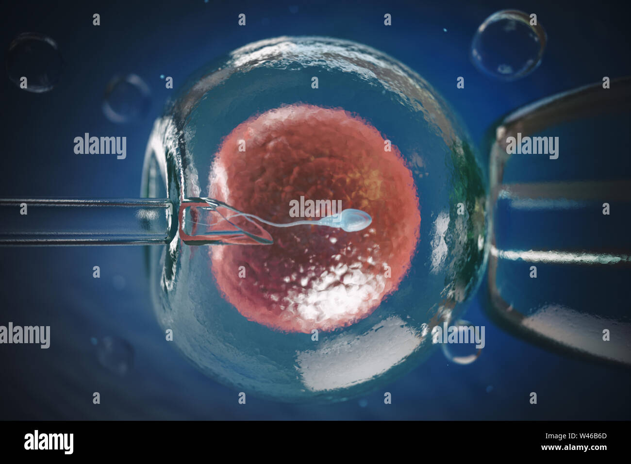 Artificial insemination, in vitro fertilization IVF of human egg cell ... Artificial insemination, in vitro fertilization IVF of human egg cell ...