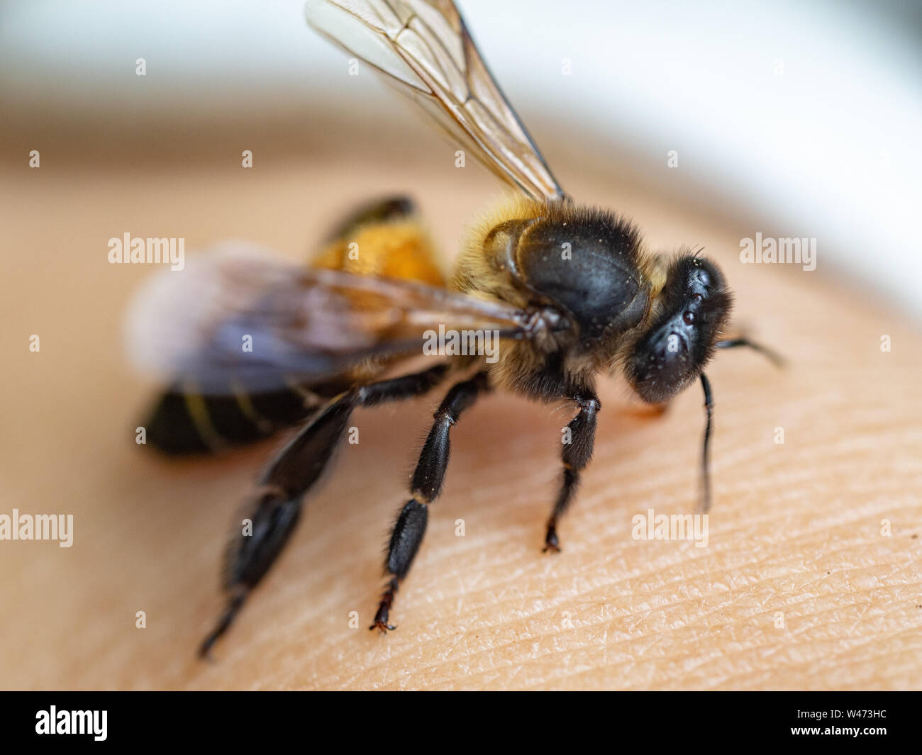 Bug Bite Skin High Resolution Stock Photography and Images - Alamy