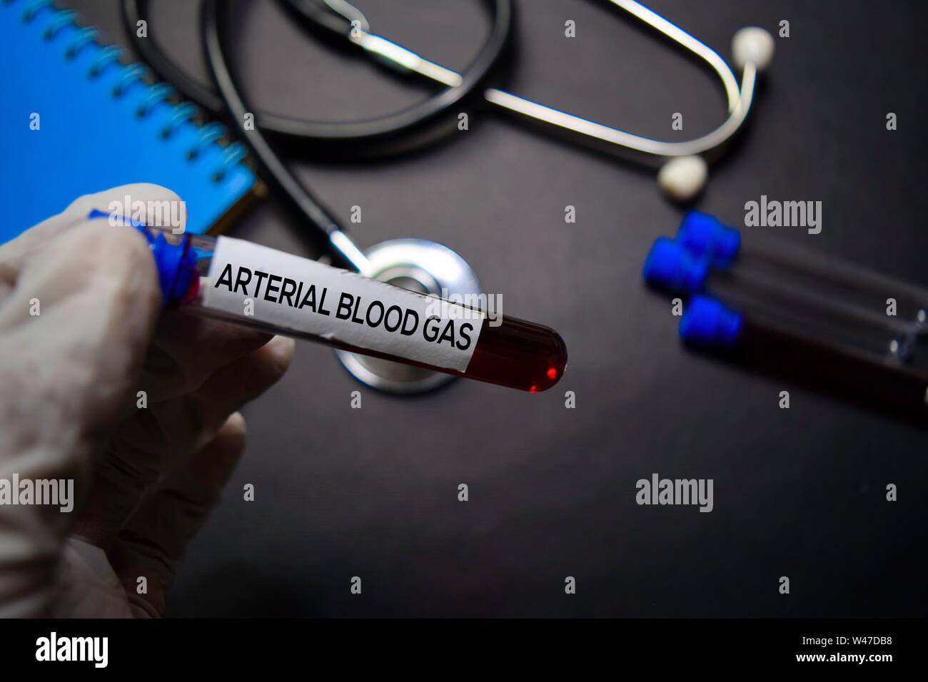 Arterial Blood Gas text on Sticky Notes. Top view isolated on black ...