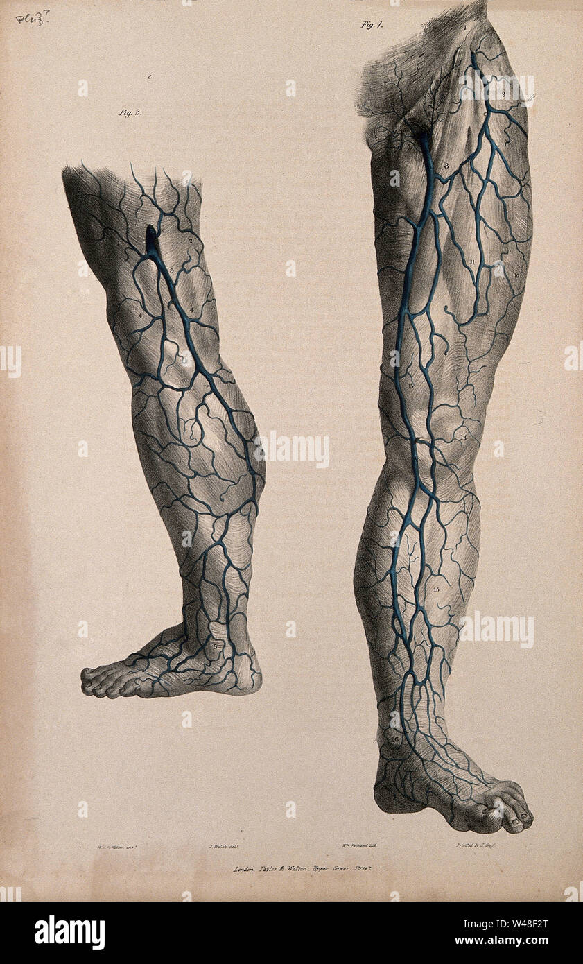 Human leg veins hi-res stock photography and images - Alamy