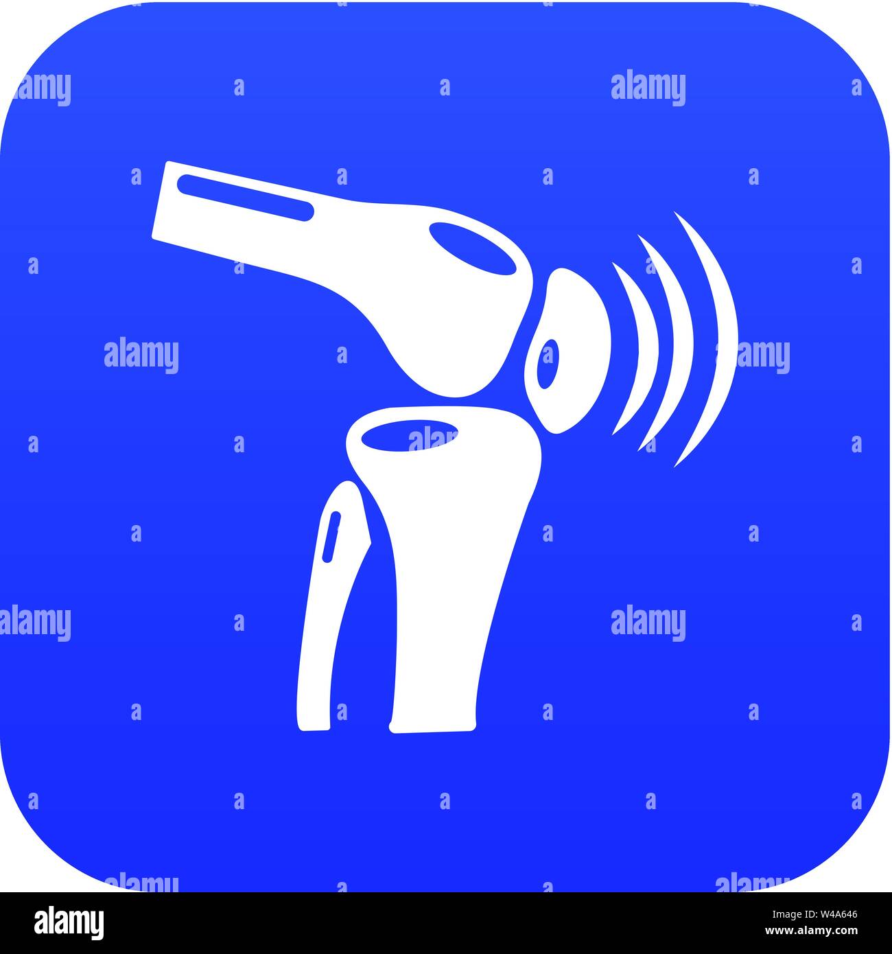 Simple fracture xray hi-res stock photography and images - Alamy