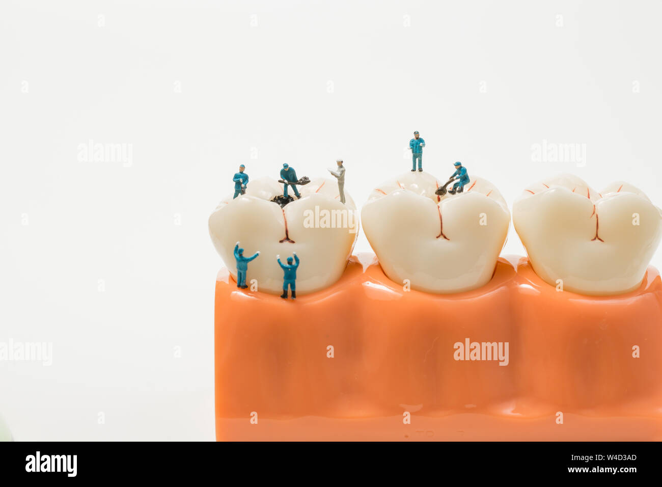 People to clean tooth model on white background,miniature Stock Photo ...