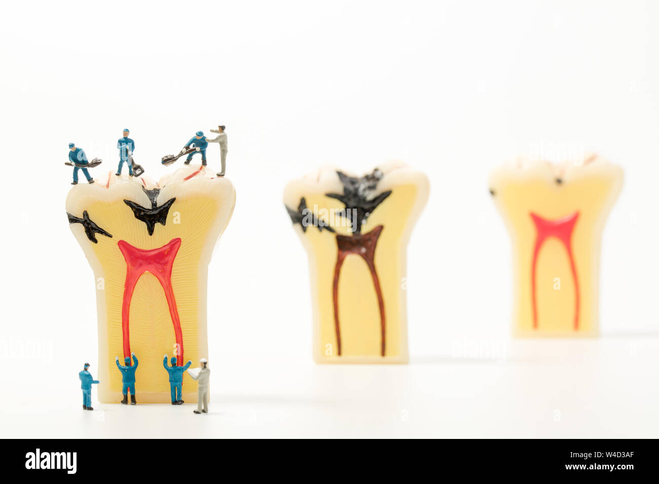 People to clean tooth model on white background,miniature Stock Photo ...