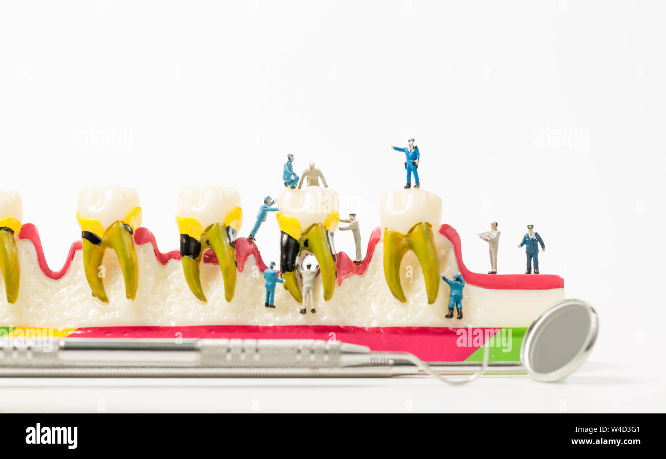 People to clean tooth model on white background,miniature Stock Photo ...