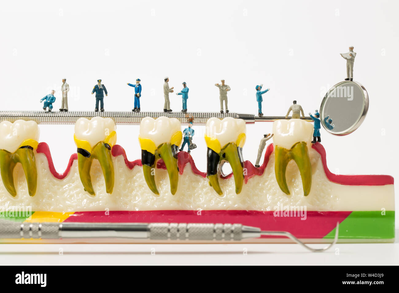 People to clean tooth model on white background,miniature Stock Photo ...