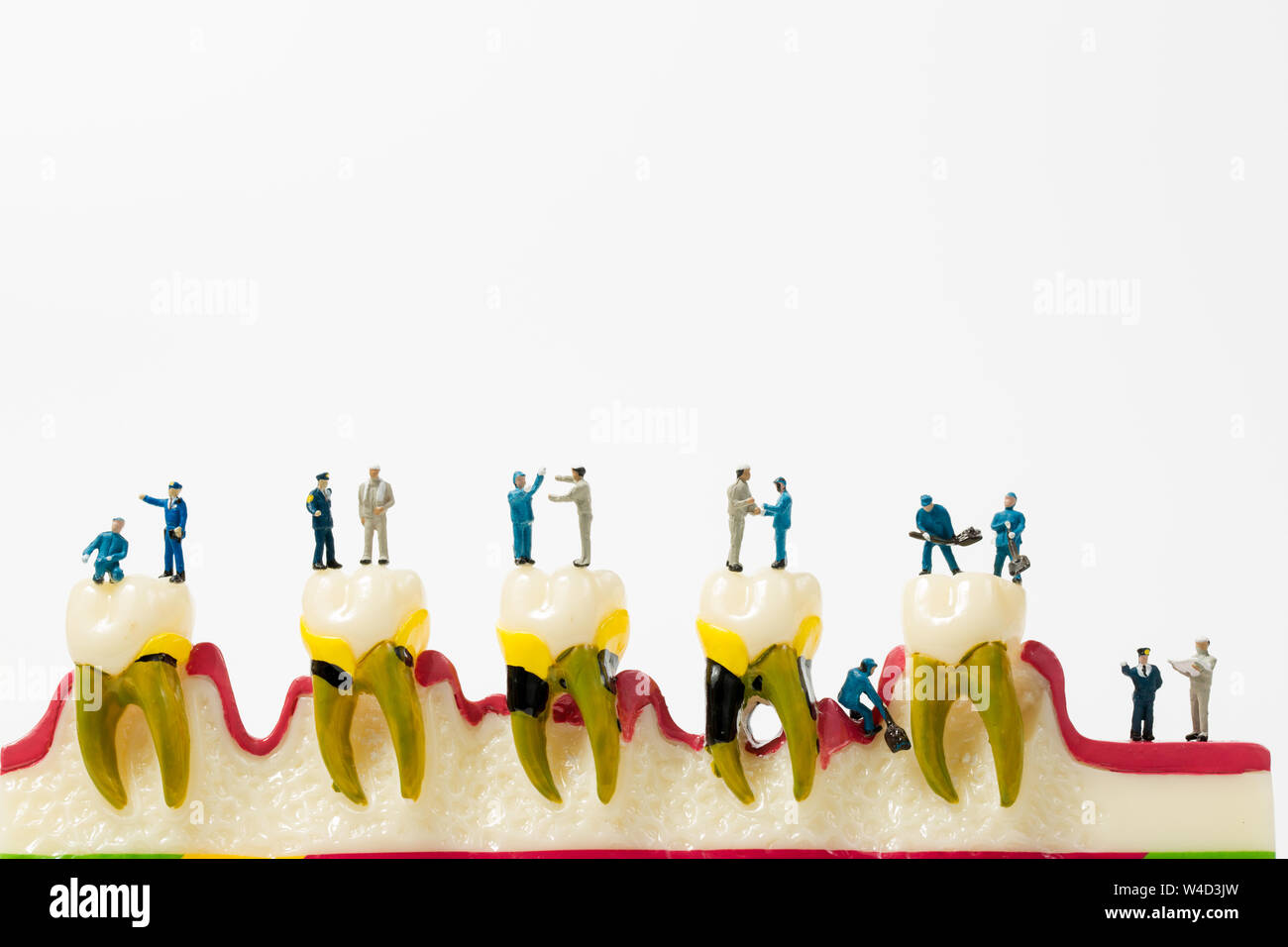 People to clean tooth model on white background,miniature Stock Photo ...
