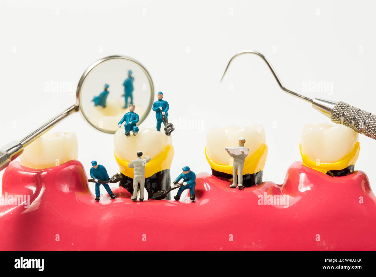 People to clean tooth model on white background,miniature Stock Photo ...