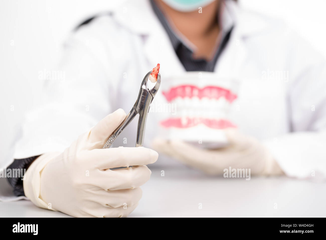 tooth is removed with dental forceps Stock Photo - Alamy