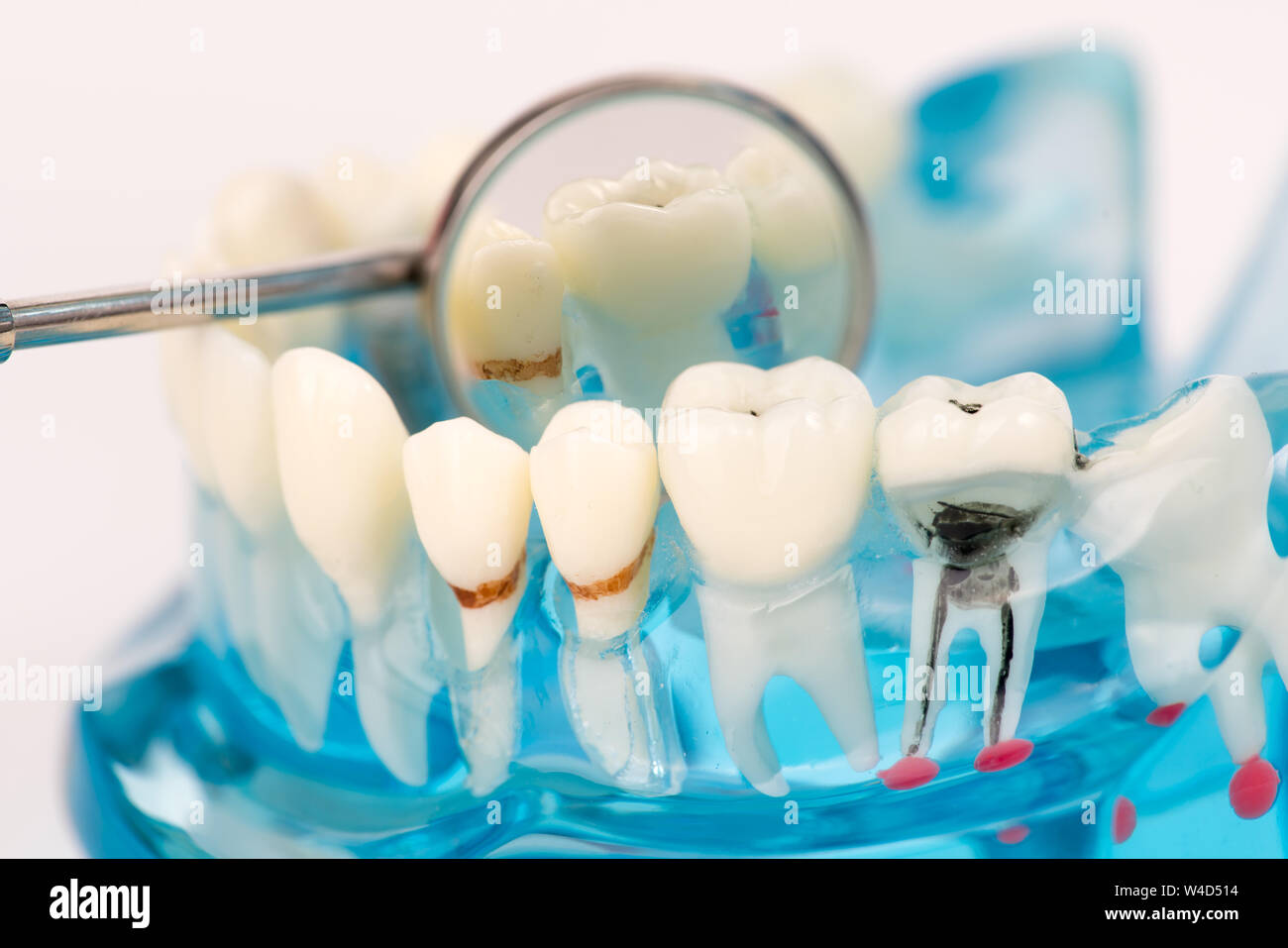 close up dental or tooth model with mirror Stock Photo - Alamy