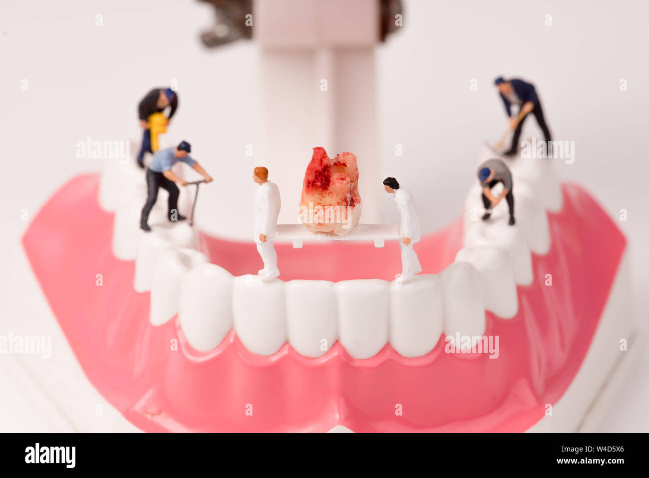 miniature people and dental model,dental care concept Stock Photo - Alamy