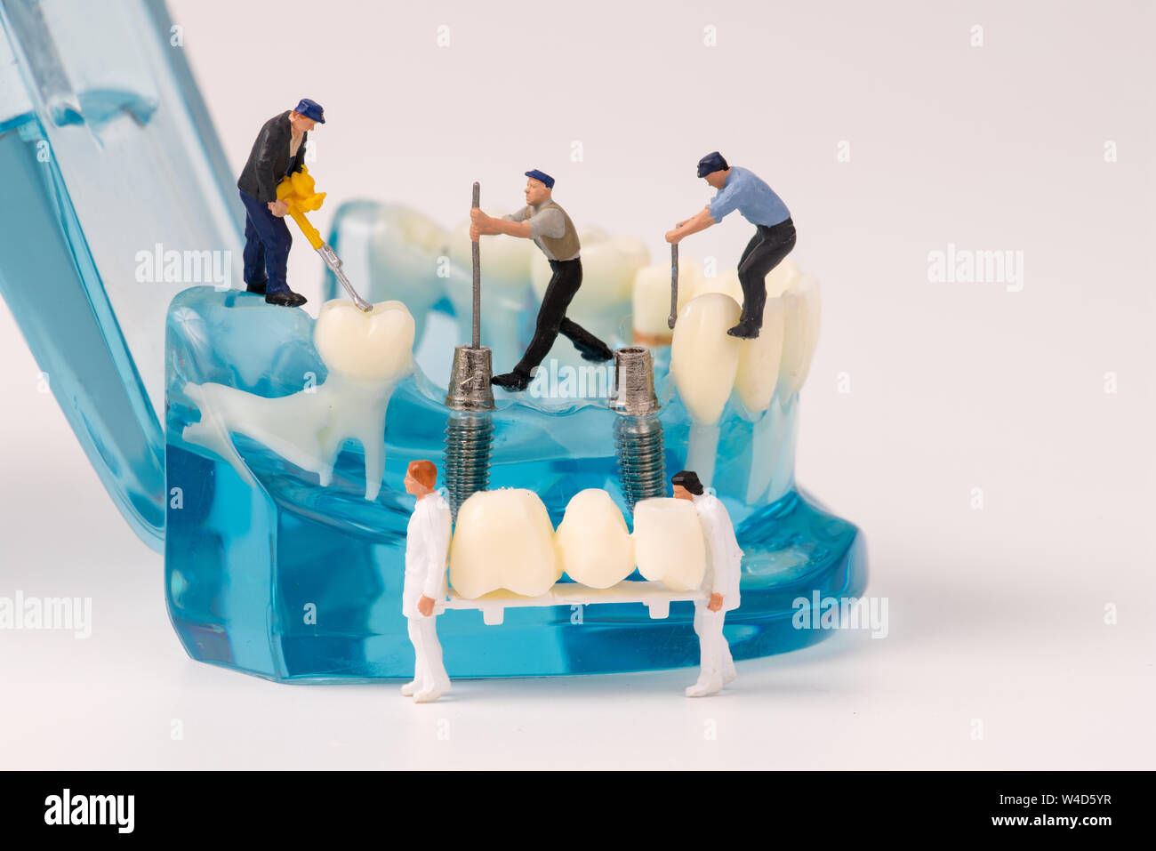 miniature people and dental model,dental care concept Stock Photo - Alamy