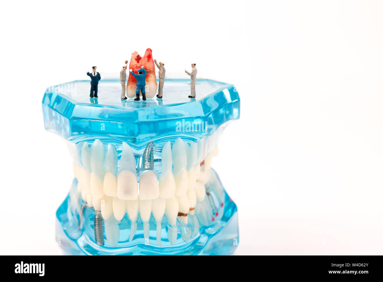 miniature figure people with dental model Stock Photo - Alamy