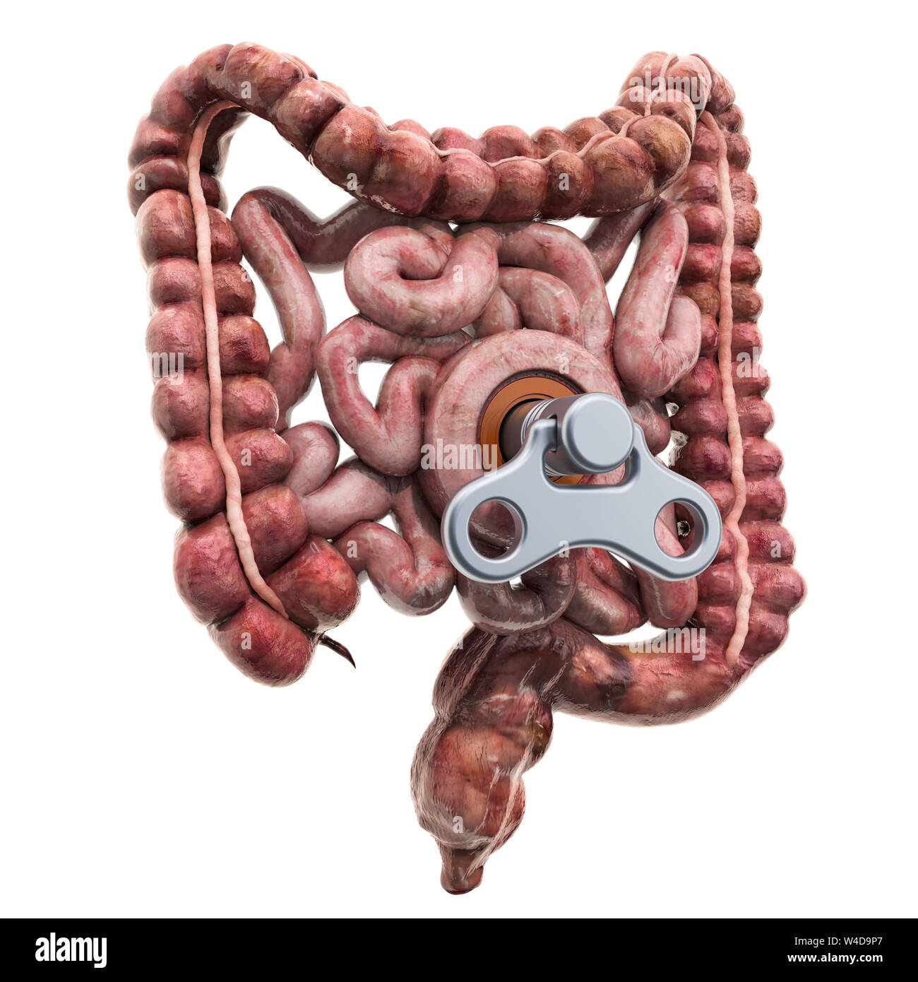Human bowel with wind-up key. Treatment and recovery concept.3D ...