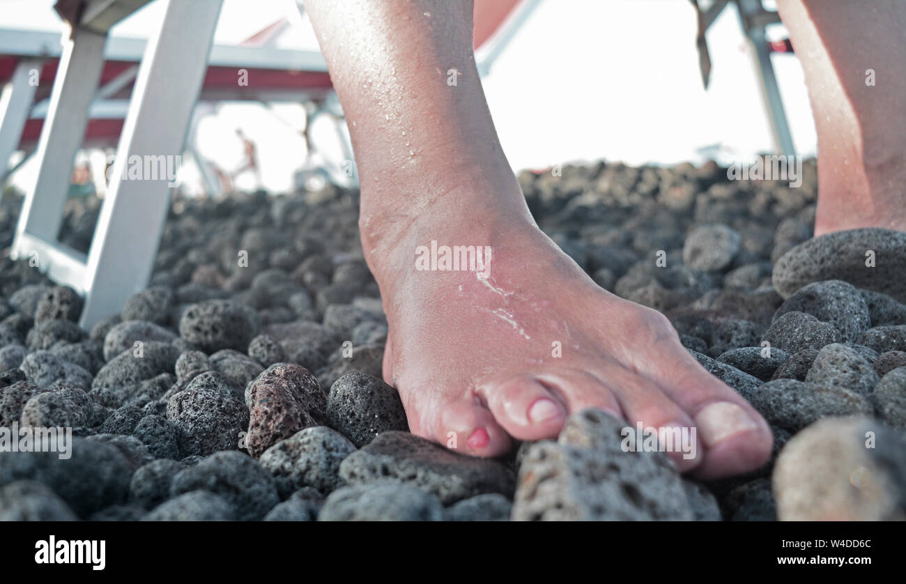 Foot injury hi-res stock photography and images - Alamy