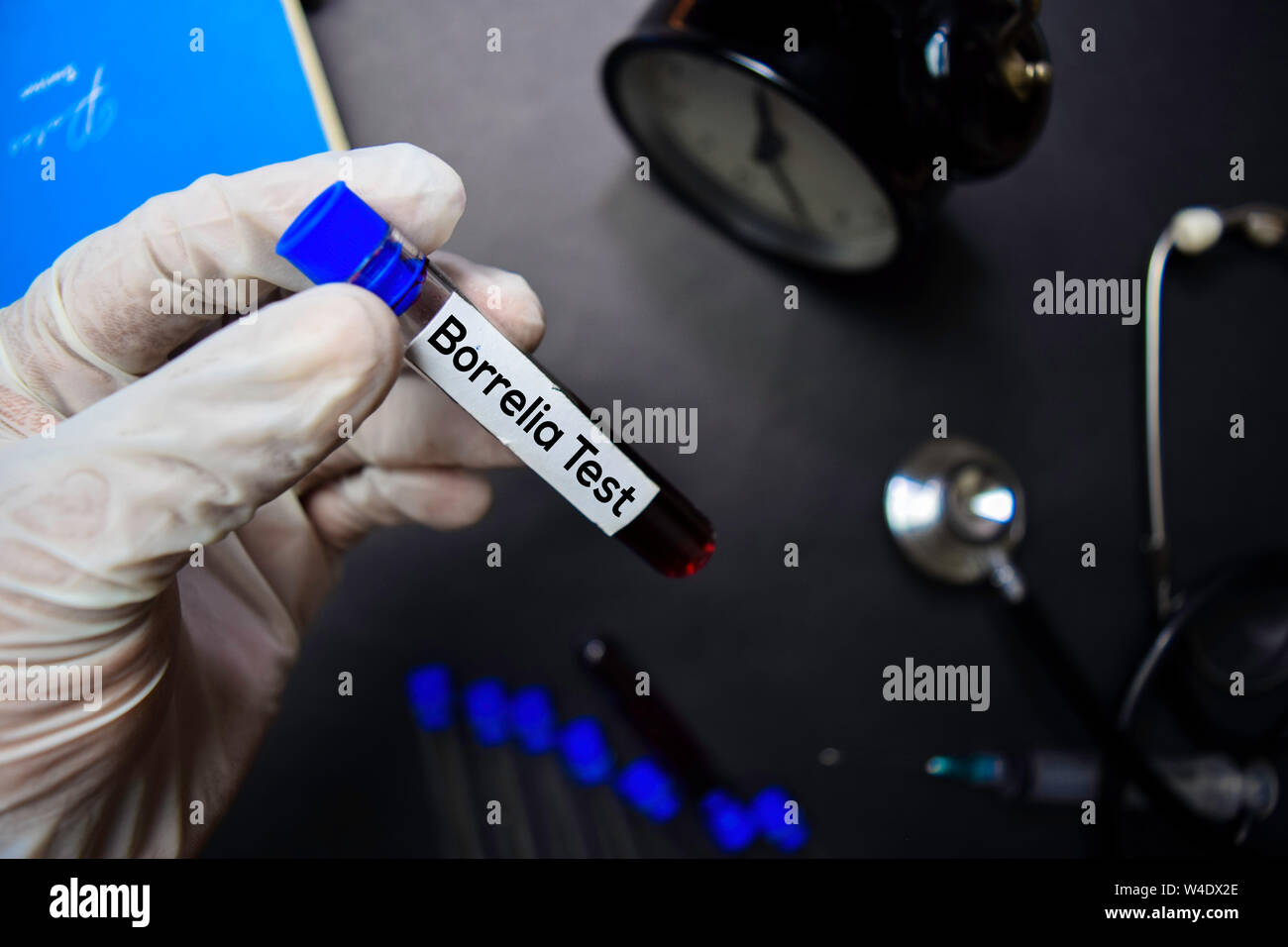 Borrelia Test text with blood sample. Top view isolated on black ...