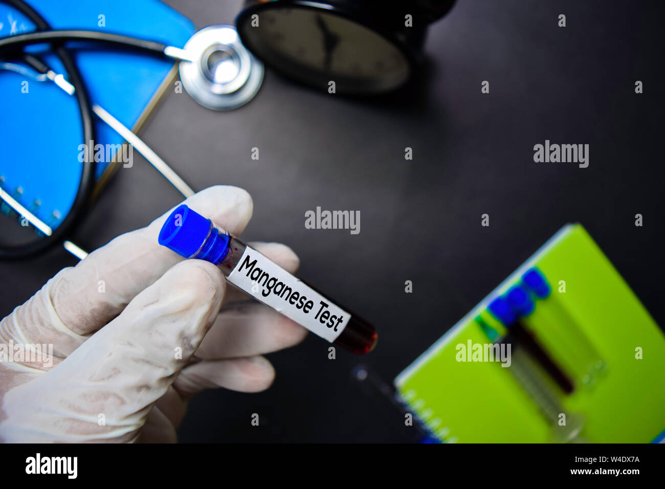 Manganese Test text with blood sample. Top view isolated on black ...