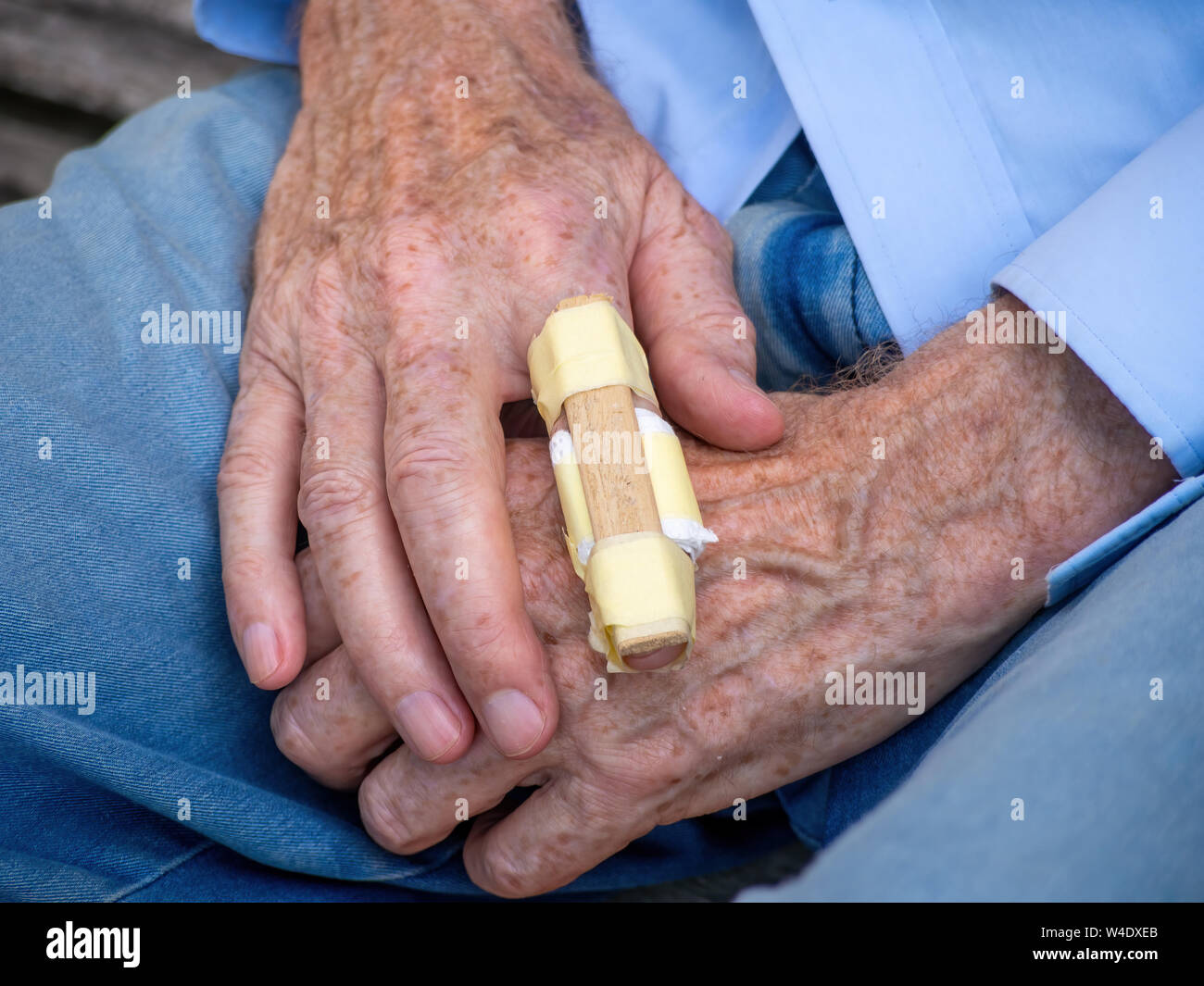 Mans hand with an improvised splint on finger. Do it Yourself First aid ...