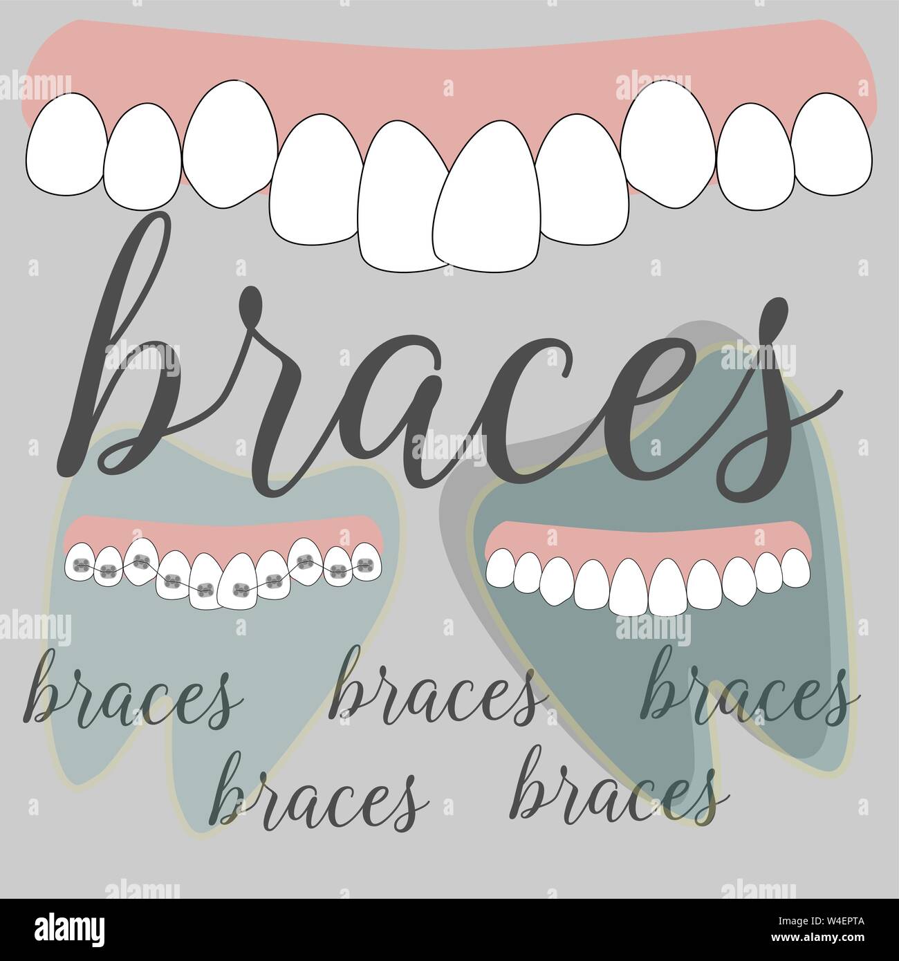 Braces dentistry in beautiful style. Vector flat design illustration ...