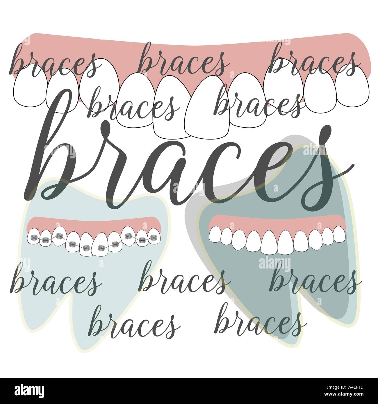 Braces dentistry in beautiful style. Vector flat design illustration ...