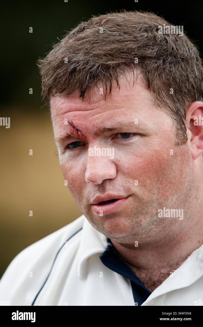 Head wound stitches hi-res stock photography and images - Alamy