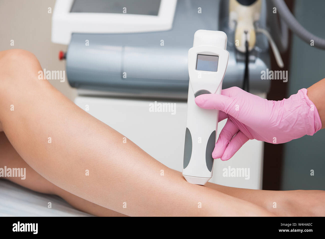 Specialist makes skin tone measurements on a womans leg Stock Photo - Alamy