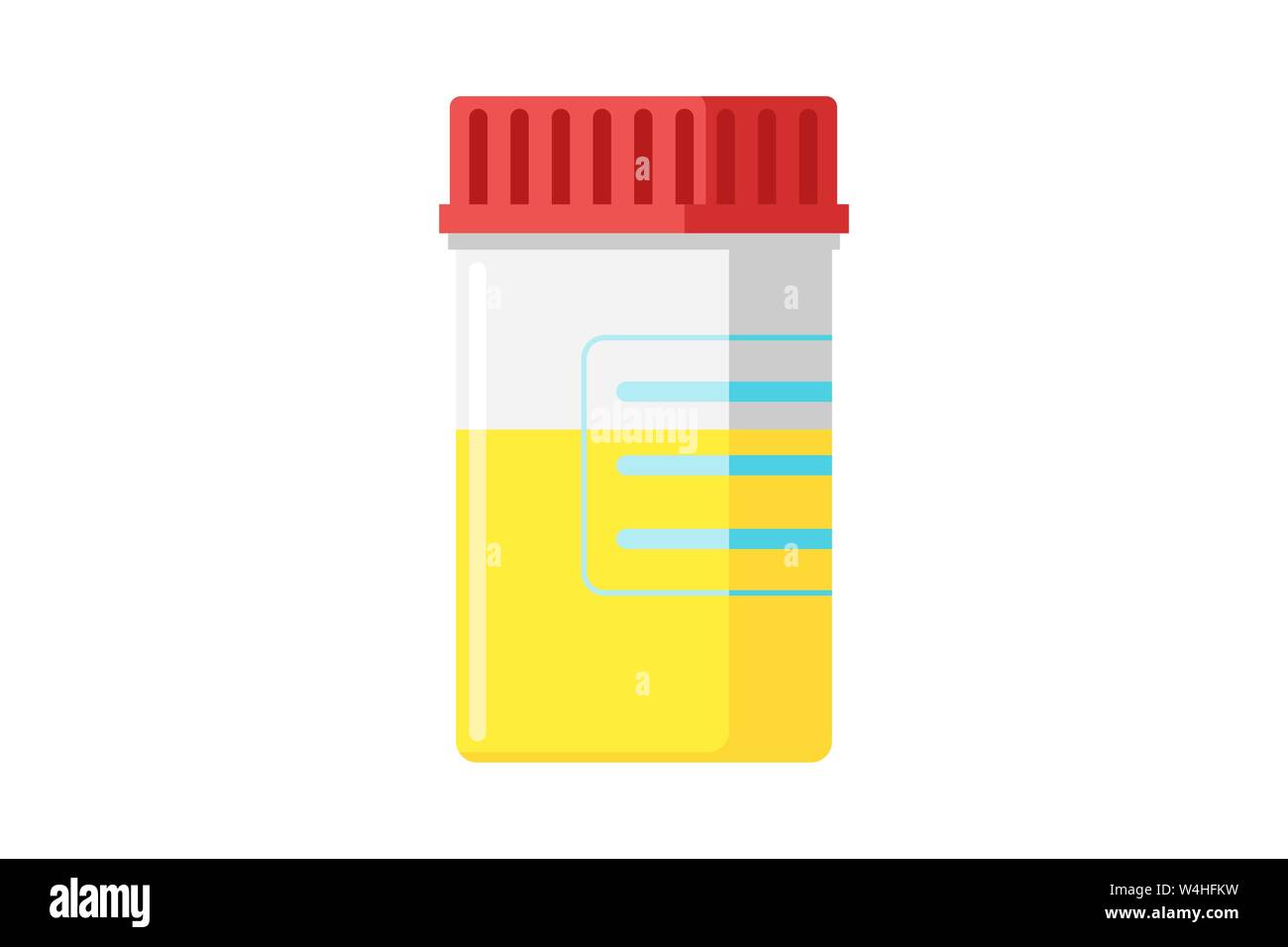 Urinalysis medical examination in plastic jar. Urine lab test analysis ...
